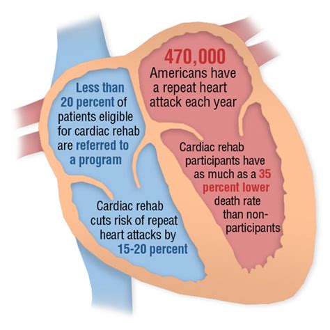 Five Things To Know Cardiac Rehabilitation Magazine Uab