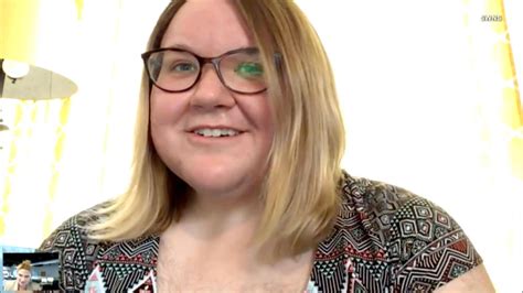 Woman With Hormonal Imbalance Embraces Her Excess Chest Hair Women