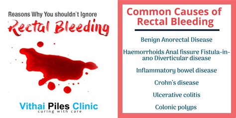 Rectal Bleeding – Causes And Treatment Vithaipileshospital