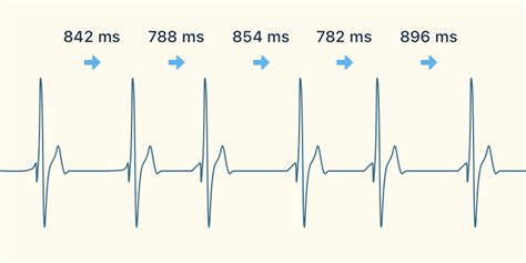 Heart Rate Variability Hrv And Meditation Training — Fitmind