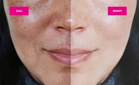 Dull Skin 7 Skincare Tips To Get Your Glow Back Biore Skincare
