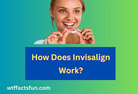 How Does Invisalign Work 2024 Fun Facts