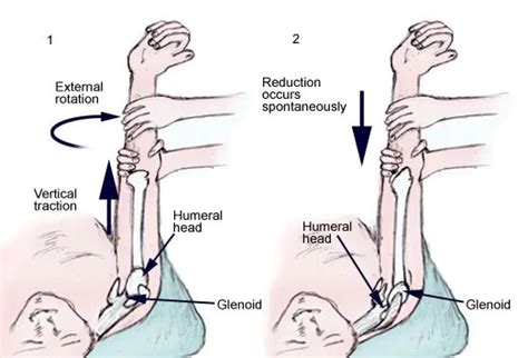 Orthopedic Medicalrojak