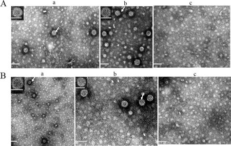 Ultrastructural Analysis Of Vlps Obtained From E Coli A And From P