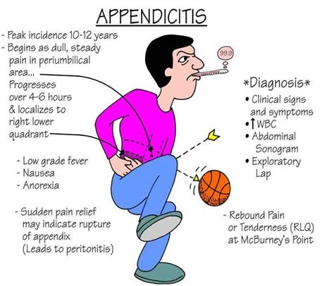 Appendicitis Signs And Symptoms