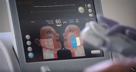 Why Ulthera Is The Best Non Surgical Way To Lift And Tighten Your Skin