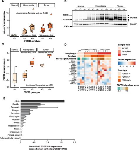 Fgfr3 Mutational Activation Can Induce Luminal Like Papillary Bladder