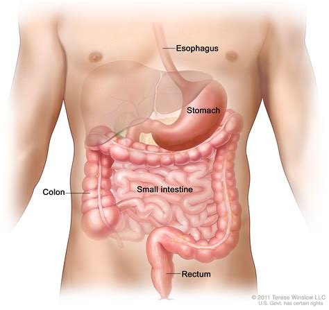 Gastrointestinal Stromal Tumor Gist Ucsf Department Of Surgery
