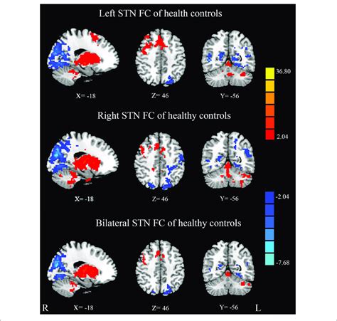 mean resting state functional connectivity fc z score maps of the