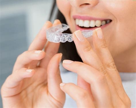 Can Invisalign Fix Overbite Discover Effective Solution