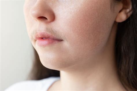 Hirsutism Symptoms Causes Treatment And More
