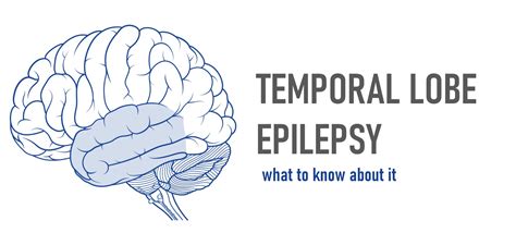Temporal Lobe Epilepsy What To Know About It