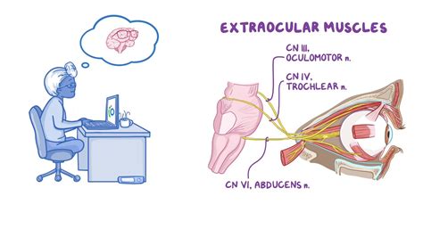 Anatomy Clinical Correlates Oculomotor Cn Iii Trochlear Cn Iv And