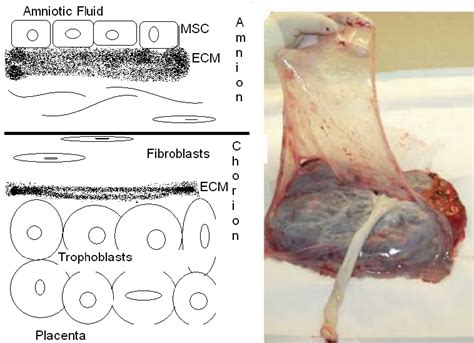 The Amniotic Membrane Is The Thin Innermost Layer Of Placenta Almost
