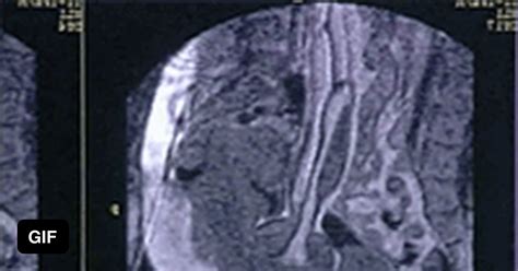 An Mri Scan Of A Couple Having Sex 9gag