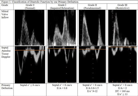 Classification Of Diastolic Function By Our Primary Definition