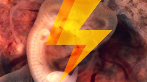 lightning learning ectopic pregnancy — em3