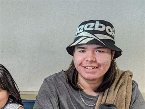 Toxic Drugs Killing First Nations Residents In B C At Nearly 6 Times