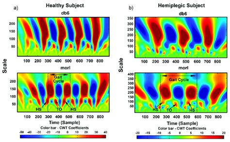 continuous wavelet transform cwt plots of the acceleration signals