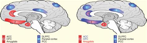 Brain Activation Patterns During A Normal Rapid Eye Movement Rem