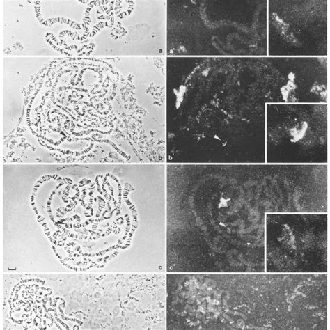 A B Microdissection Of A Drosophila Polytene Chromosome The
