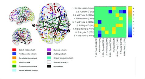 Network Based Statistics Nbs Derived Graph Component Predicted By