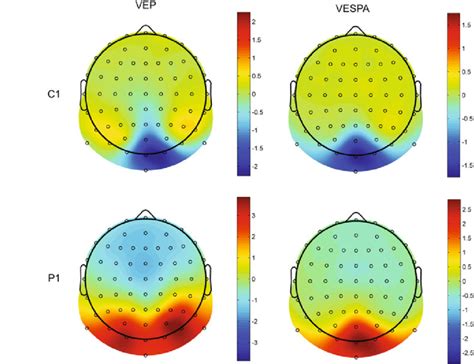 Spline Interpolated Scalp Distribution Of The C1 Component Average