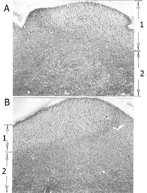 The Medial Longitudinal Strips Of Corpus Callosum Of An Adult Man A