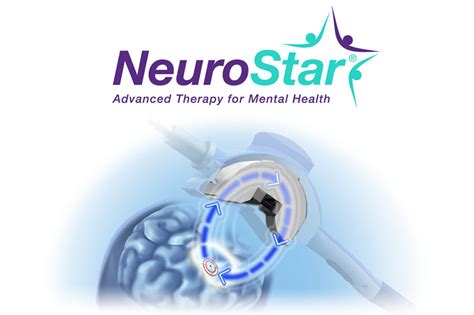 Tms Therapy For Depression In Santa Monica Ca Neurostar Tms