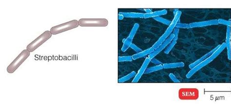 Different Size Shape And Arrangement Of Bacterial Cells When Viewed
