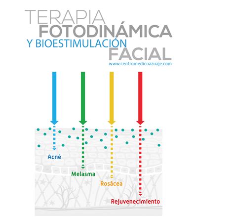 Terapia Fotodinámica Y Bioestimulación Facial Centro Médico Azuaje