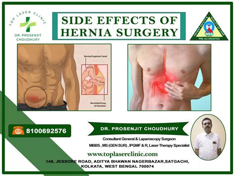 7 Long Term Side Effects Of Hernia Surgery Top Laser Clinic