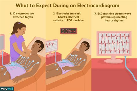 electrocardiogram ecg or ekg procedure and results