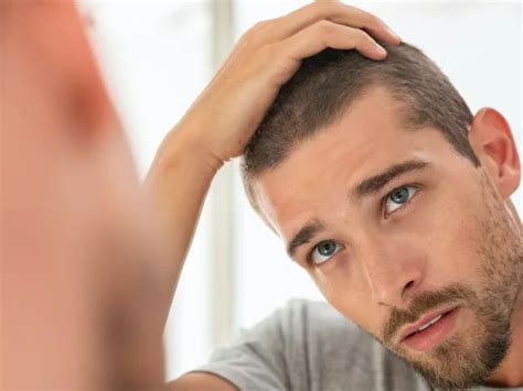 What Really Causes Hair Loss In Men And What To Do About It Hum