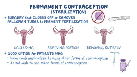 Permanent Contraception Sterilization Clinical Sciences Osmosis