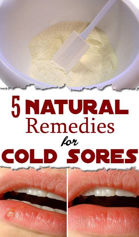 5 Natural Remedies For Cold Sores Beautiful Diy And Health
