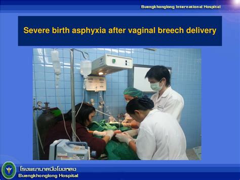 Ppt Vaginal Delivery Of Breech Presentation Powerpoint Presentation