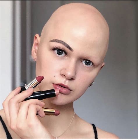 Pin By David Connelly On Bald Women 10 Bald Women Beauty Alopecia