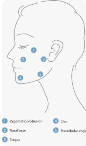 Profhilo Treatments Under The Palm Aesthetics