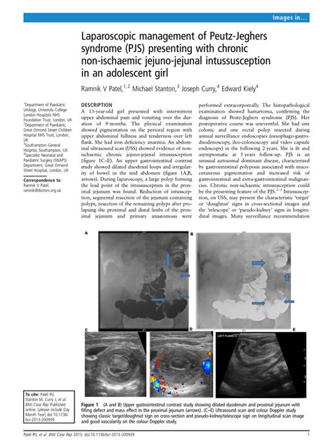Pdf Laparoscopic Management Of Peutz Jeghers Syndrome Pjs