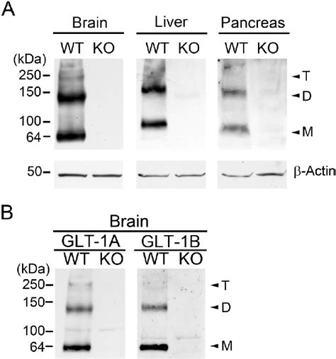 Glt 1 Protein Is Expressed In Pancreas A Western Blots Using A