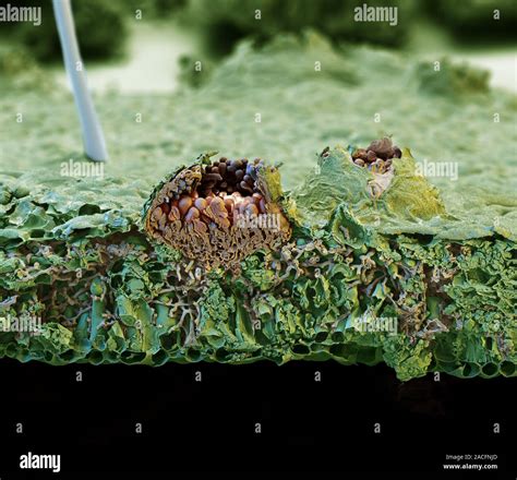 Leaf Infected With Rust Fungus Coloured Scanning Electron Micrograph