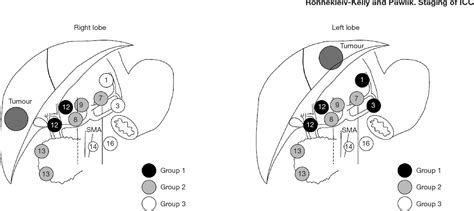 Figure 2 From Staging Of Intrahepatic Cholangiocarcinoma Semantic