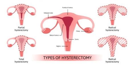 Procedures Dr Cherynne Johansson