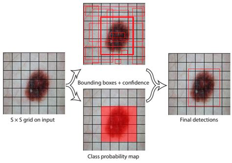 diagnostics free full text skin lesion segmentation in dermoscopic