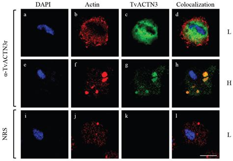 Biomolecules Free Full Text Rna Binding Proteins In Trichomonas