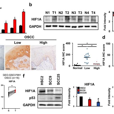 Effects Of Hif 1α And Par3 On Oscc Tumor Metastasis In Vivo Hsc 2