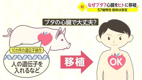 ブタの心臓をヒトに移植…なぜブタが選ばれたのか？ 移植の男性容体は安定