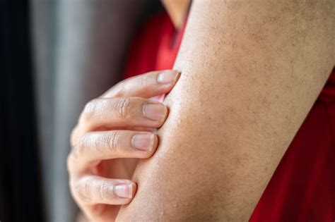 Common Causes Of Bumps On Elbows With Pictures