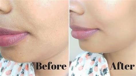 Remove Facial Hairs Permanently At Home How To Remove Facial Hairs